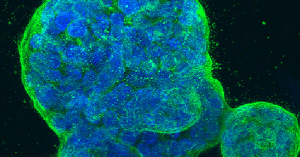 Research Areas: Cancer Biology - National Cancer Institute