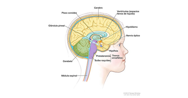 Tumores cerebrales—Versión para pacientes - National Cancer Institute