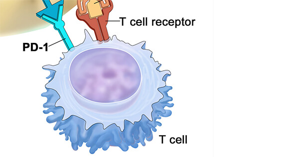 Atezolizumab for Bladder Cancer - National Cancer Institute