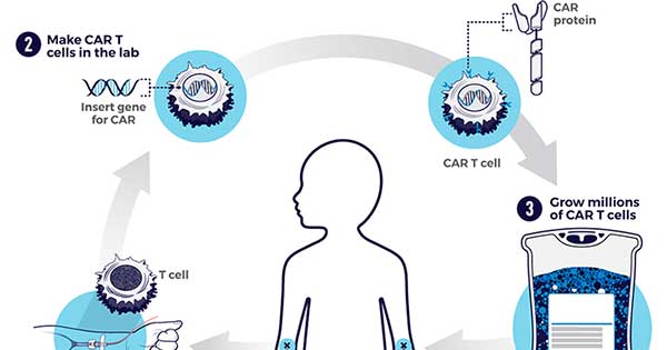 CAR T-Cell Therapy Infographic - National Cancer Institute