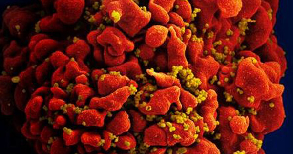 HIV Infection and Cancer Risk - National Cancer Institute