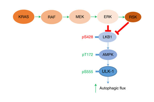 Hitting an Elusive Target in Pancreatic Cancer - National Cancer Institute