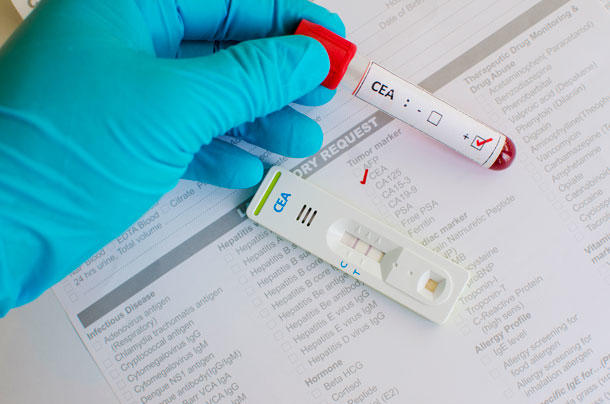Do Frequent Follow Up Tests Help Colorectal Cancer Survivors NCI do-frequent-follow-up-tests-help-colorectal-cancer-survivors-nci