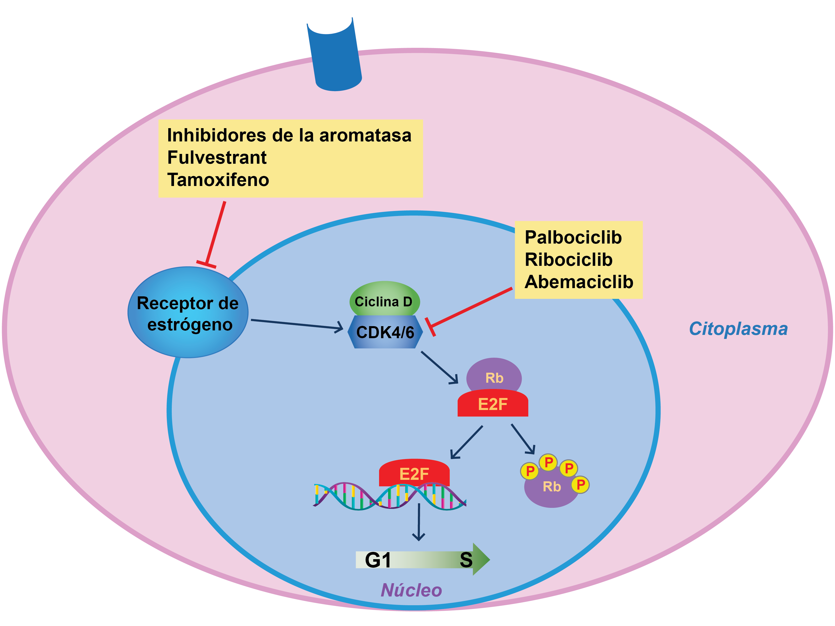 El ribociclib prolonga la supervivencia de pacientes con cáncer de seno ...