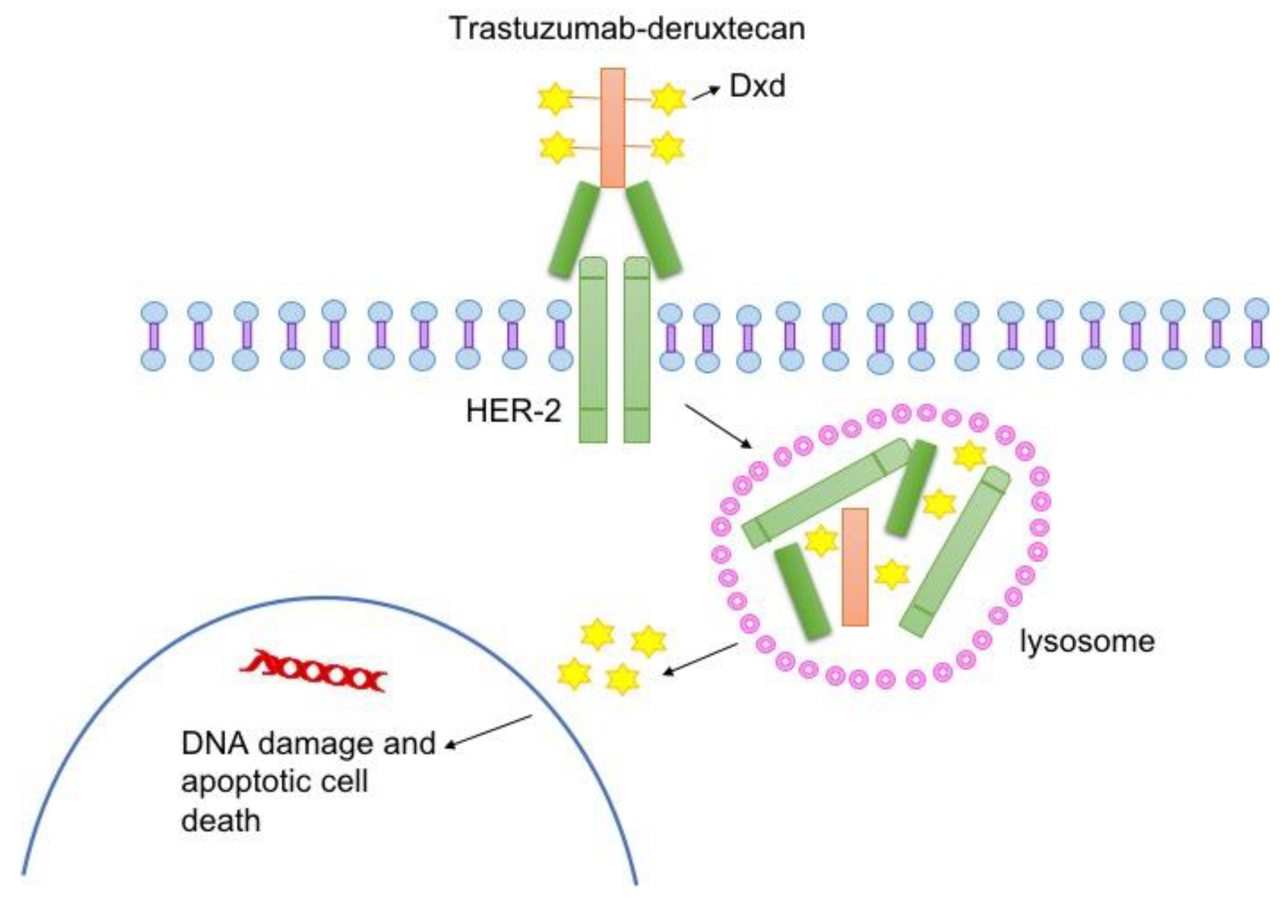 Trastuzumab Deruxtecan for Metastatic HER2-Low Breast Cancer - NCI