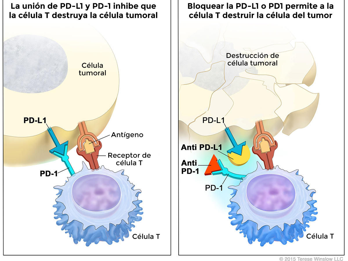 FDA aprueba el pembrolizumab para pacientes con cáncer de pulmón de ...