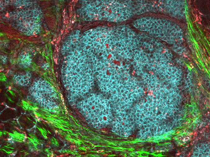 Tumor Biology and Microenvironment Research - NCI