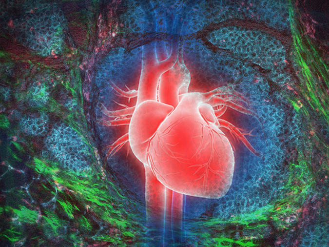 Heart Attack May Make Breast Cancer Grow Faster - NCI