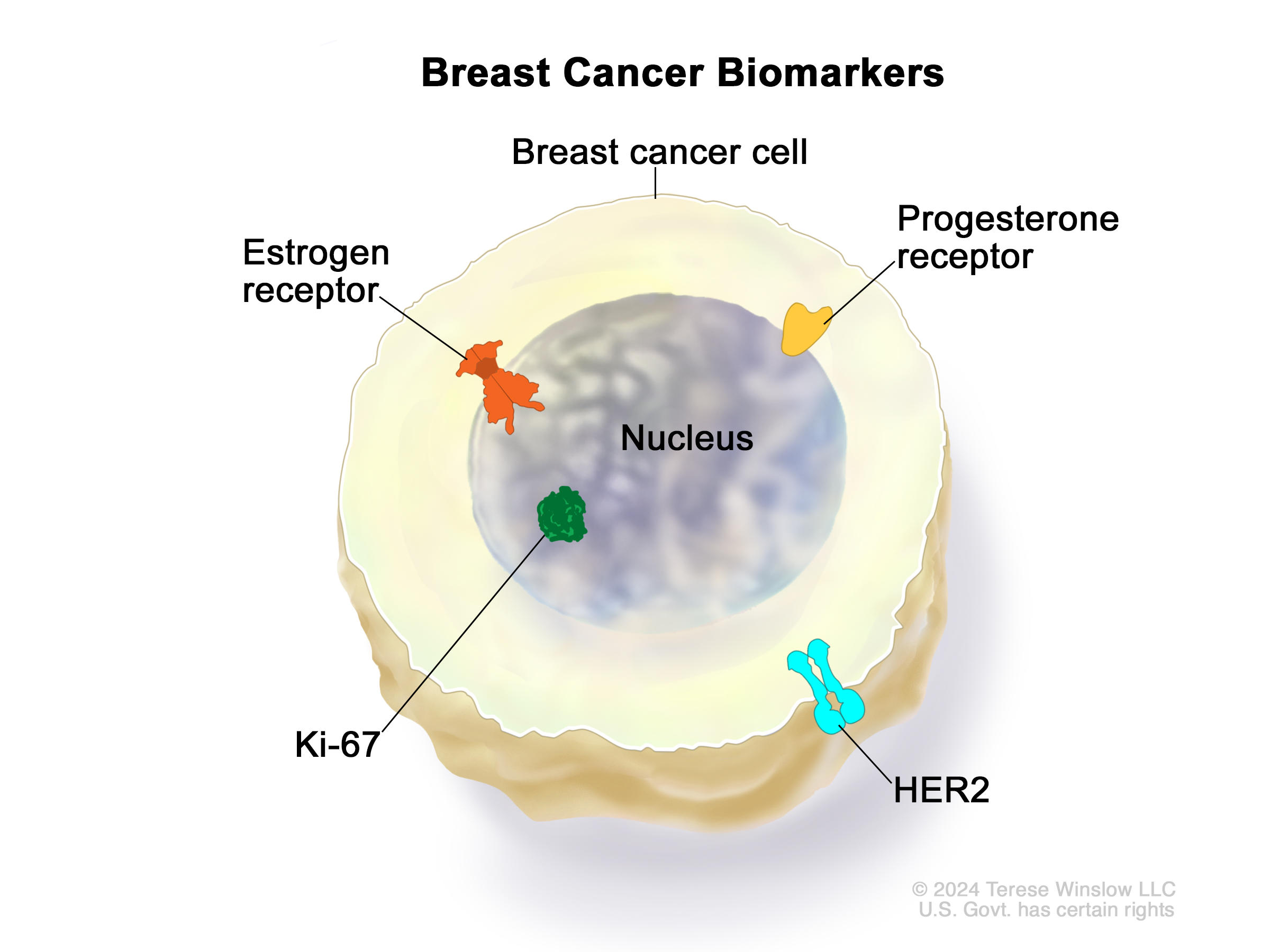 Breast Cancer Biomarkers | Hormone Receptors, HER2, and Others - NCI