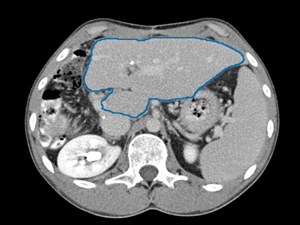 New Artificial Intelligence and Medical Imaging Annotations Added to ...