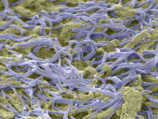 Bacterial Biofilms Provide Clues into Colorectal Cancer Risk - NCI