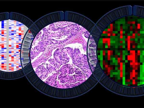 Shedding New Light on Cancer Biology - NCI