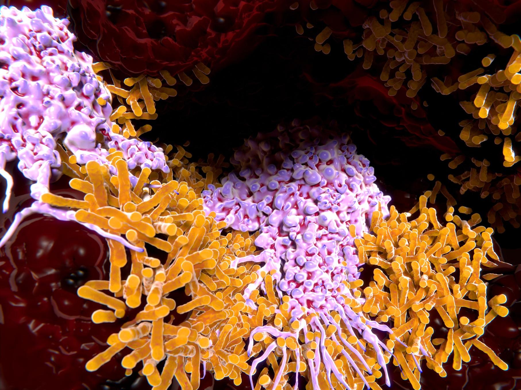 How Do Dormant Cancer Cells Become Metastases? - NCI